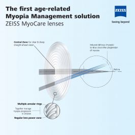 ZEISS MyoCare Lens Design